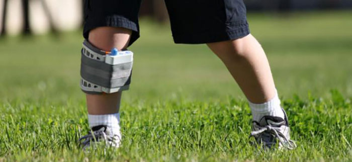 WalkAideÂ® System: Connor's new "magic foot" | TheCPBlogÂ®